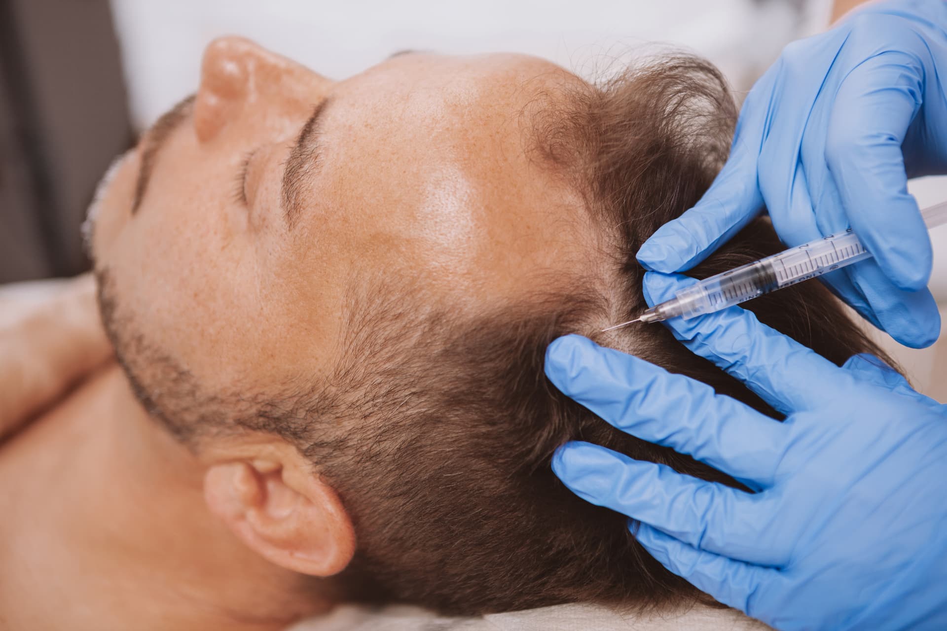 Hair Growth Treatment Lincoln | Functional Aesthetics